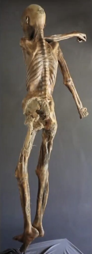 Dr. Kevin Pauza & the Final Days of Ötzi the Iceman - Dr. Kevin Pauza ...